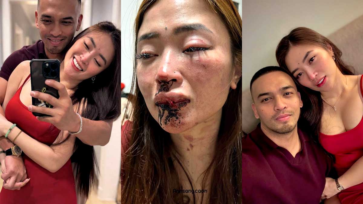 Jam Ignacio binugbog daw fiancé na si DJ Jellie Aw; Ogie Diaz may hamon ...